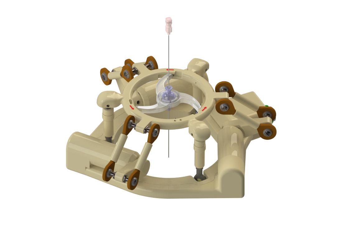 ANT-X - Automated Needle Targeting - NDR Medical Technology